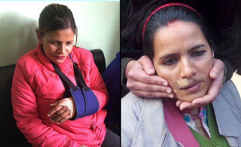 पद्मकन्या क्याम्पसमा कुटाकुट – Online Khabar